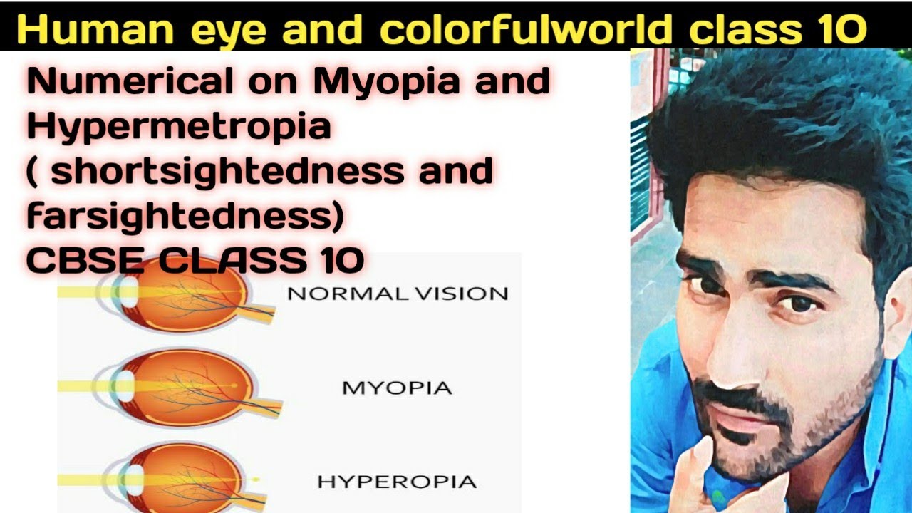 MYOPIA AND HYPERMETROPIA( NEARSIGHTEDNESS/FARSIGHTEDNESS) PROBLEM ...