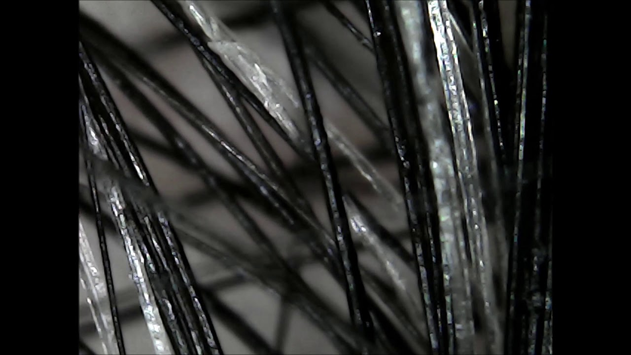 Oily Greasy Hair under the Microscope - YouTube