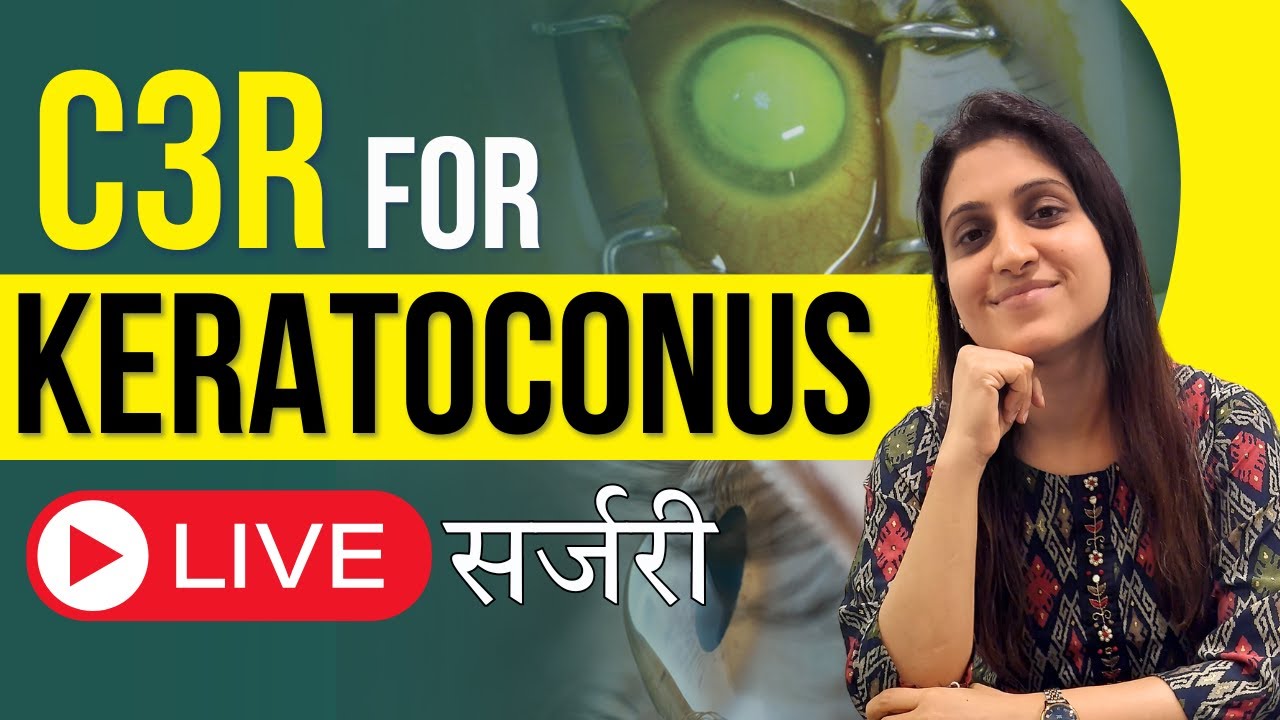 C3R Surgery For Keratoconus I Procedure & Benefits - YouTube