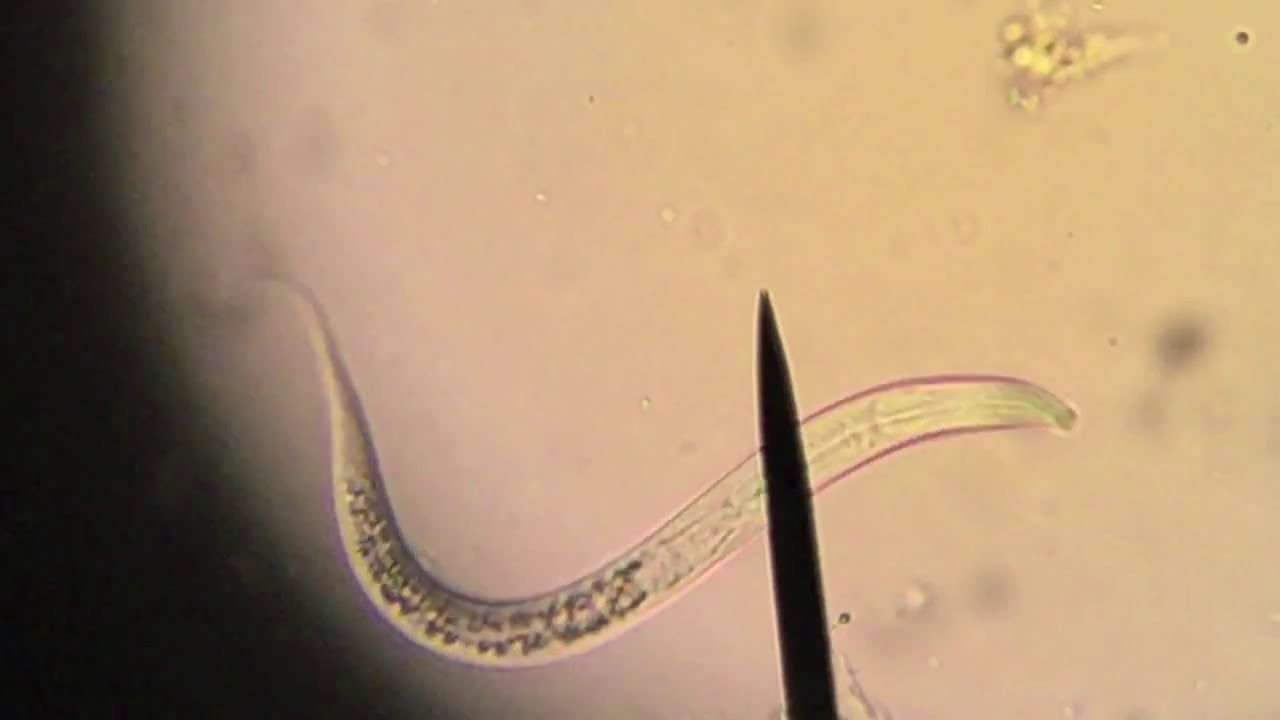 Bacteria feeding nematode - YouTube