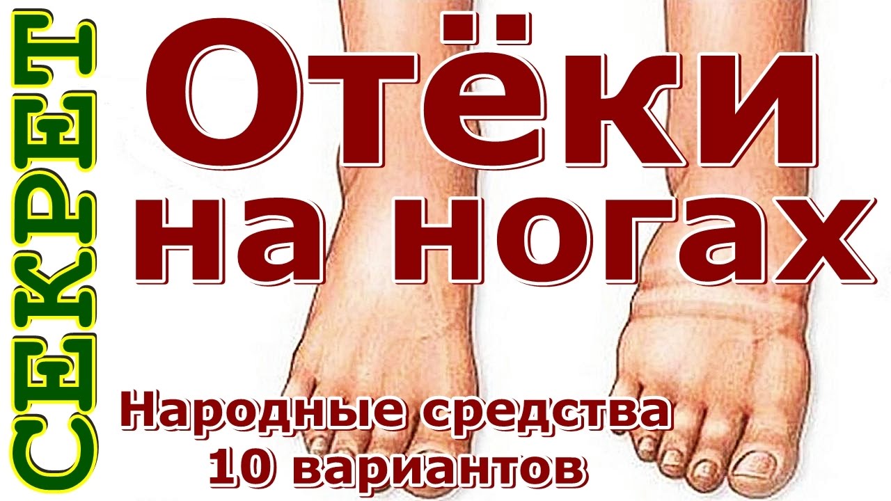 лечение отеков ног - YouTube