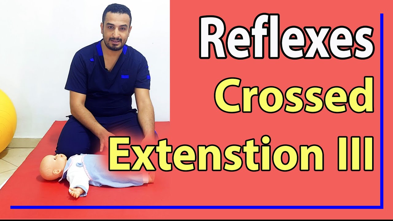 05 Crossed Extension Reflex III - YouTube