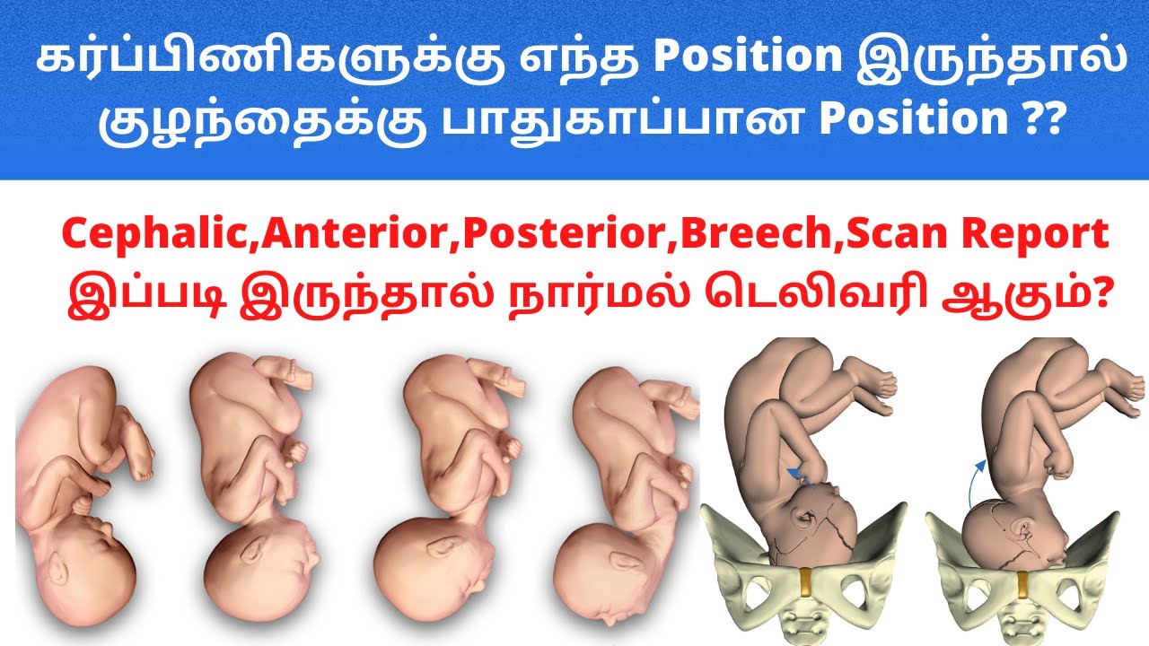 Fetal Position In Tamil symptoms Of Baby Turning Head Down In Tamil fetal-position-in-tamil-symptoms-of-baby-turning-head-down-in-tamil