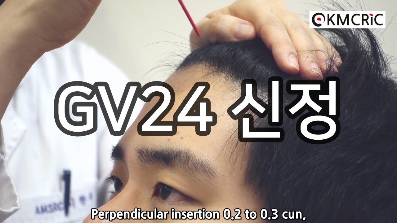 GV24 신정 神庭 Shenting (Eng sub) - KMCRIC WHO Standard acupoint DB - YouTube