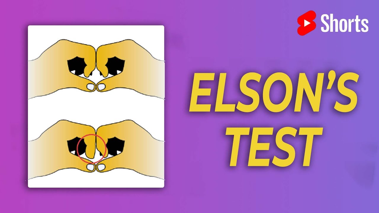 The Modified Elson's Test - YouTube