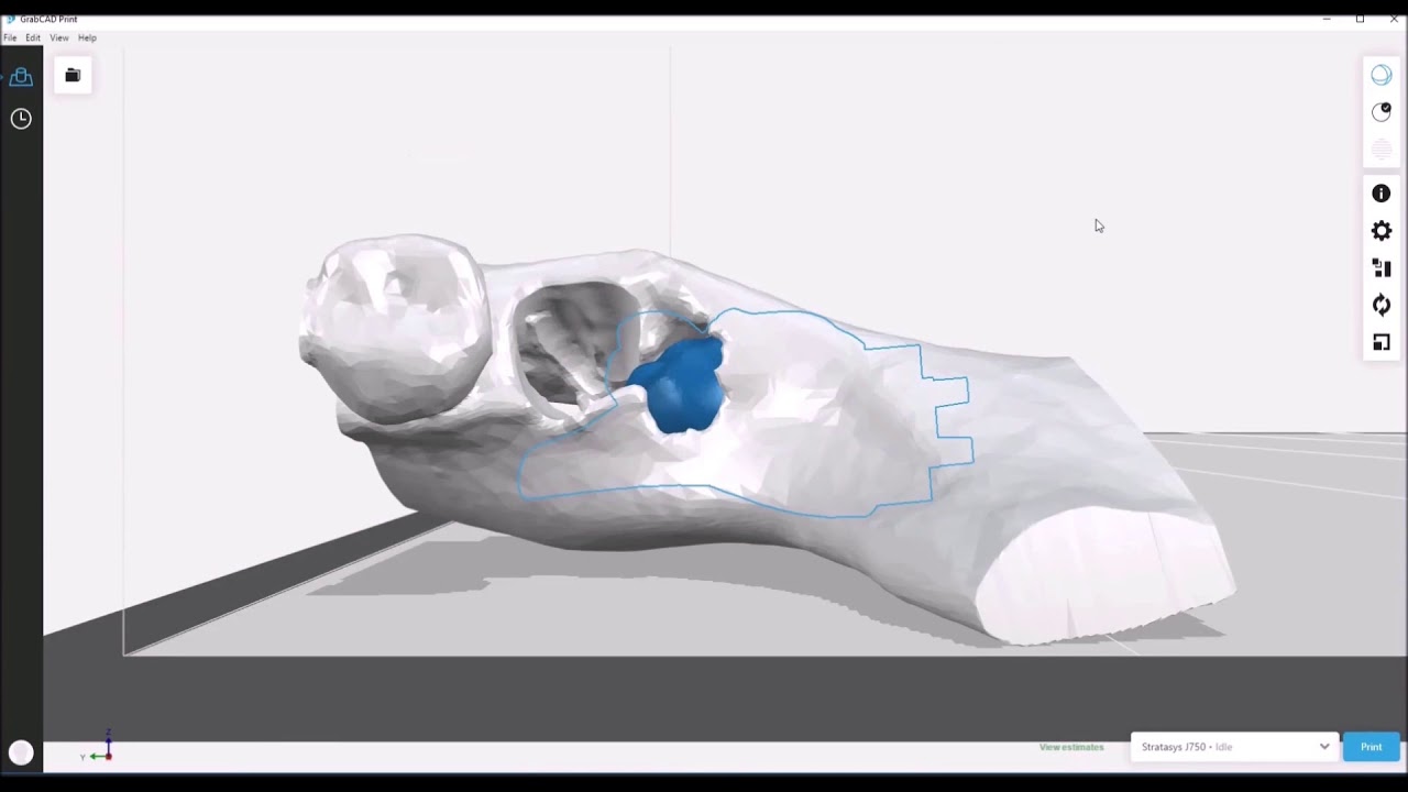 Printing Process - Third molar 3D Printing Process - YouTube