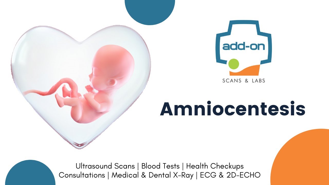 What is Amniocentesis and How it is done? | amniotic fluid test ...