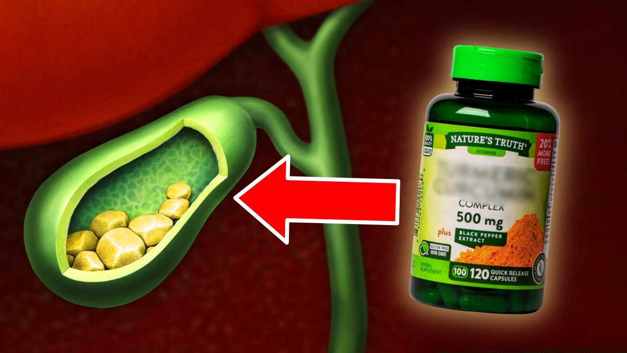 Forget Surgery! Dissolve Gallstones Naturally With This Little-Known ...