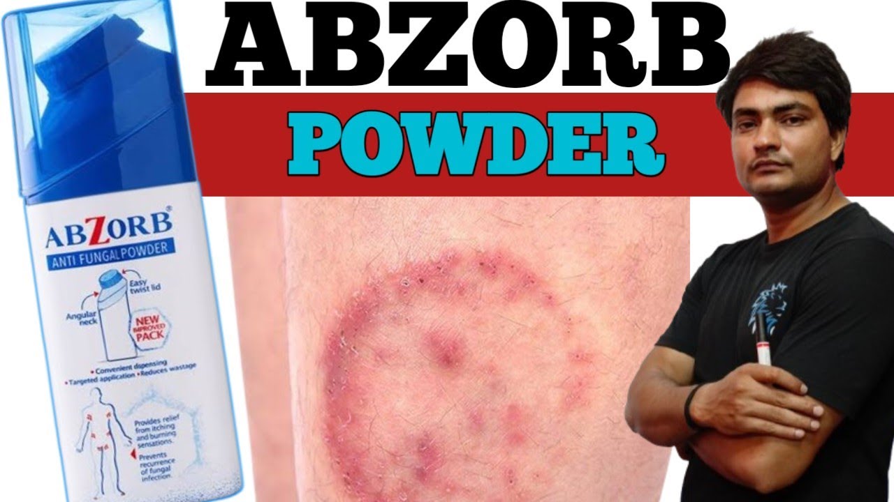 abzorb antifungal powder | abzorb antifungal powder how to use | abzorb ...