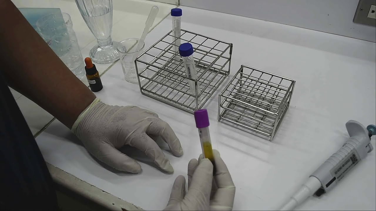 Topic 6 : Knott's concentration technique - YouTube