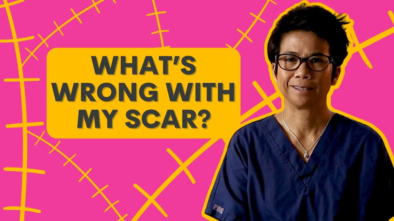 Understanding Scar Complications: Causes and Solutions - with Dr Tasha ...