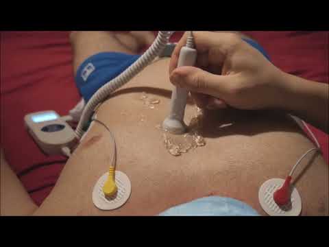 ECG of my heart and doppler