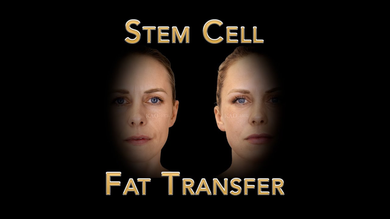 New Advancements In Plastic Surgery and Facial Rejuvenation - Cultured ...