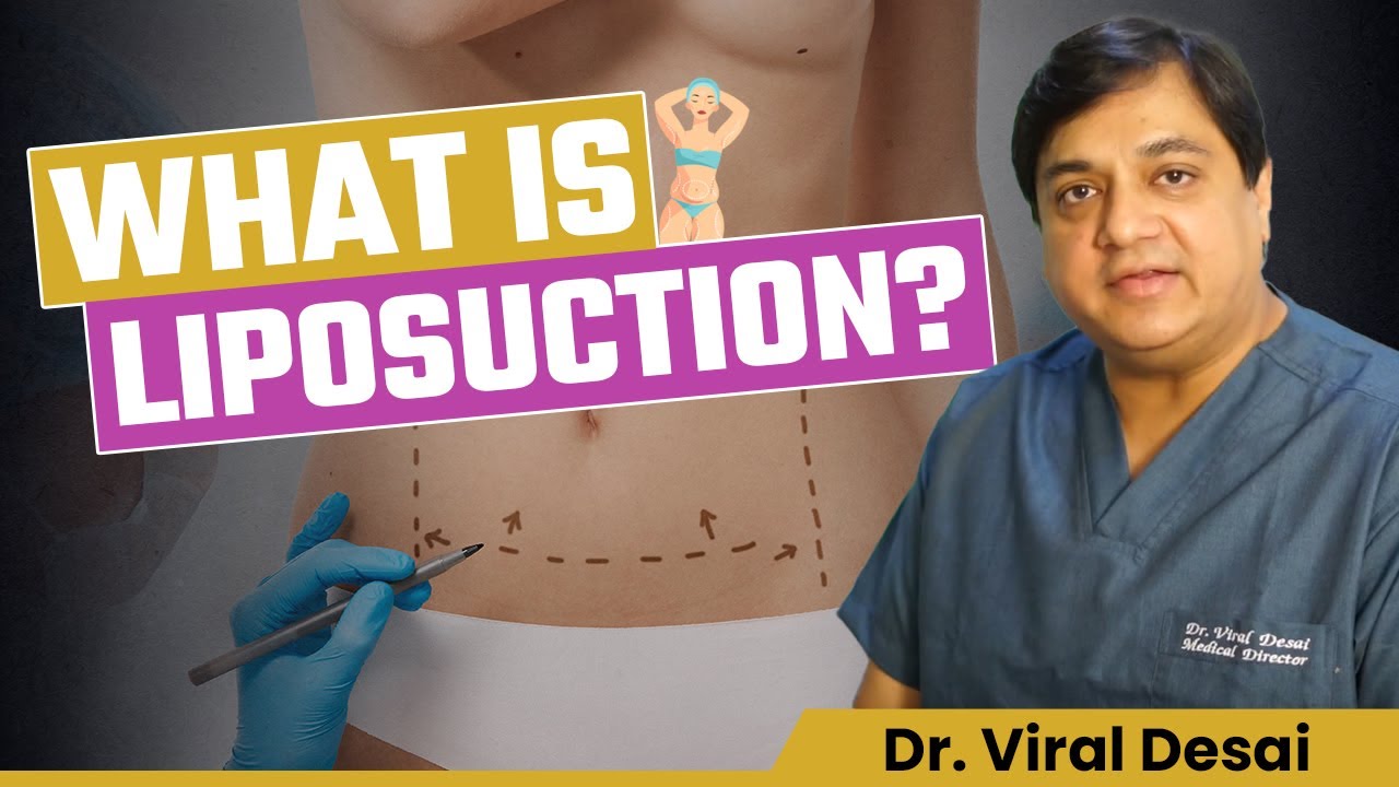 What is Liposuction? | How Does Lipsuction Works? | Dr. Viral Desai ...