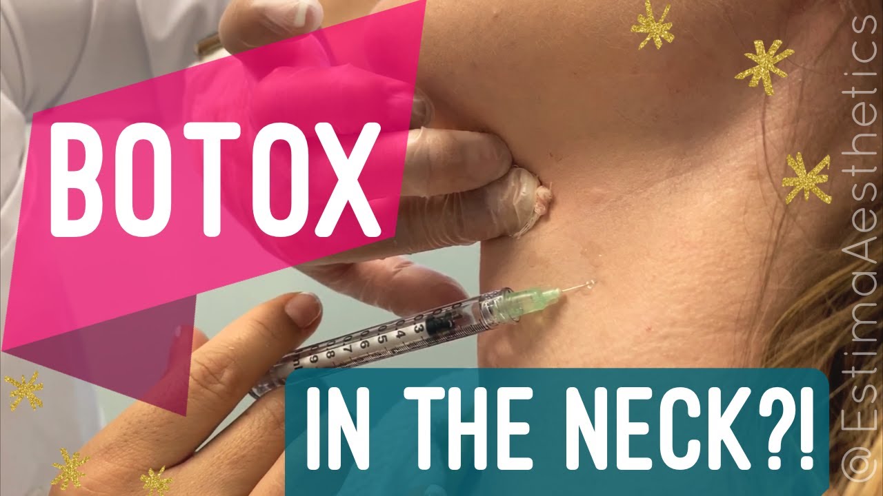BOTOX Neck Rejuvenation for Turkey Neck Prevention and Correction - YouTube