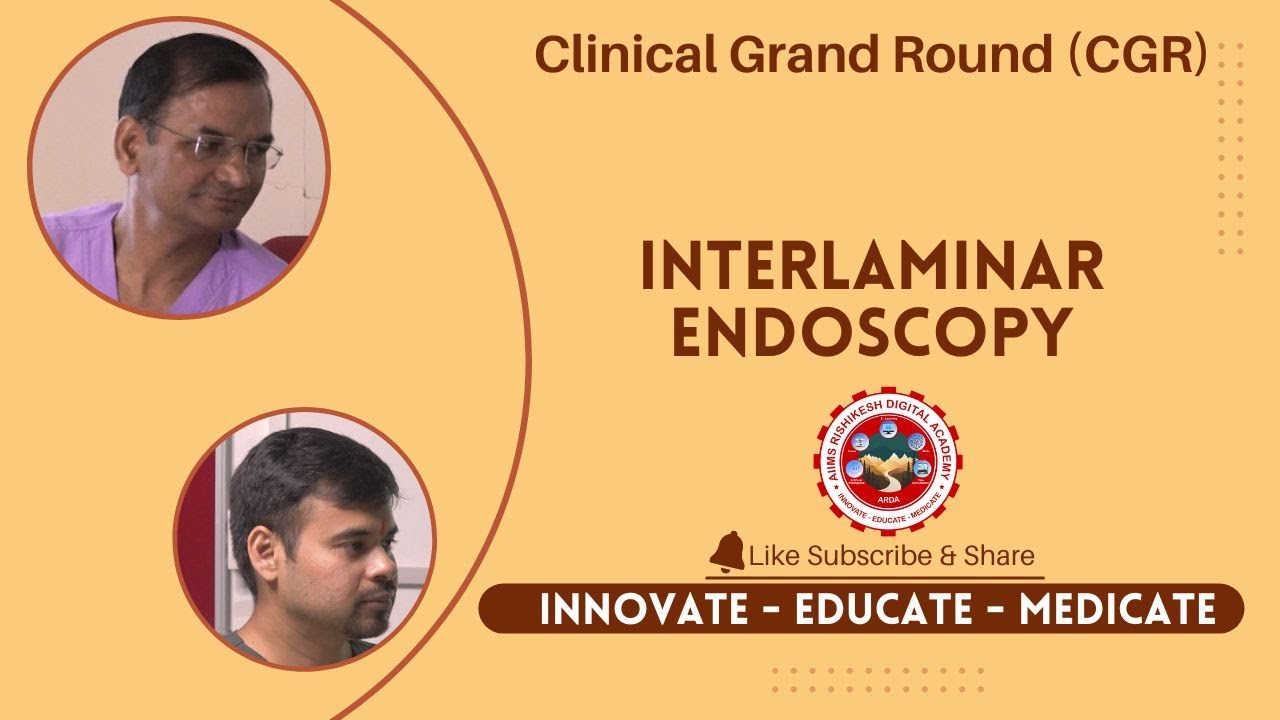 Interlaminar Endoscopy: Clinical Grand Rounds - YouTube