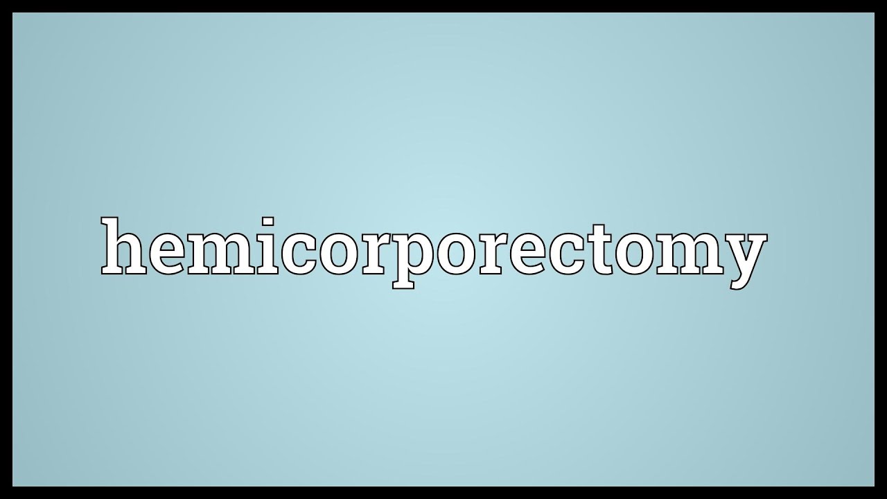 Hemicorporectomy Meaning - YouTube