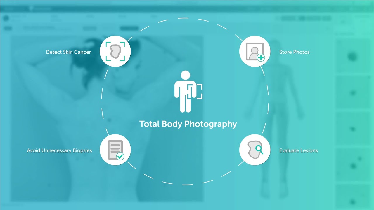 DermEngine | Total Body Photography Guide - YouTube