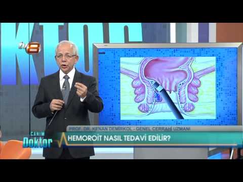 Lazer ile hemoroit tedavisi yapılır mı