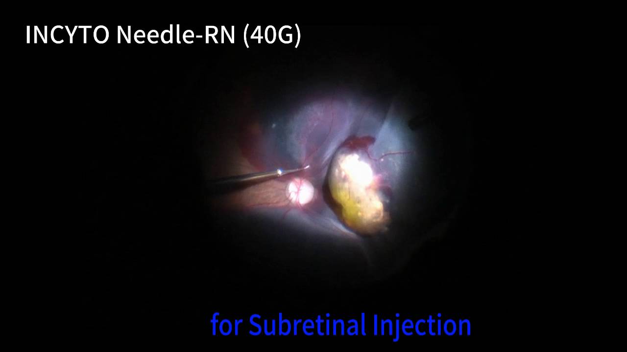 INCYTO Needle-RN (40G) for Subretinal Injection - YouTube