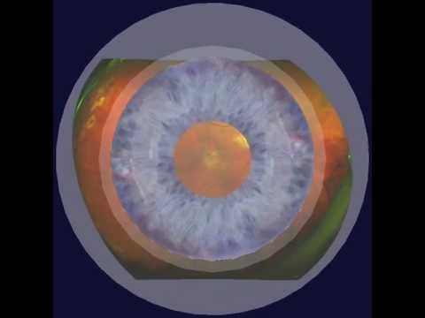 Optomap 3D Wrap: 3D Eye Mapping - YouTube