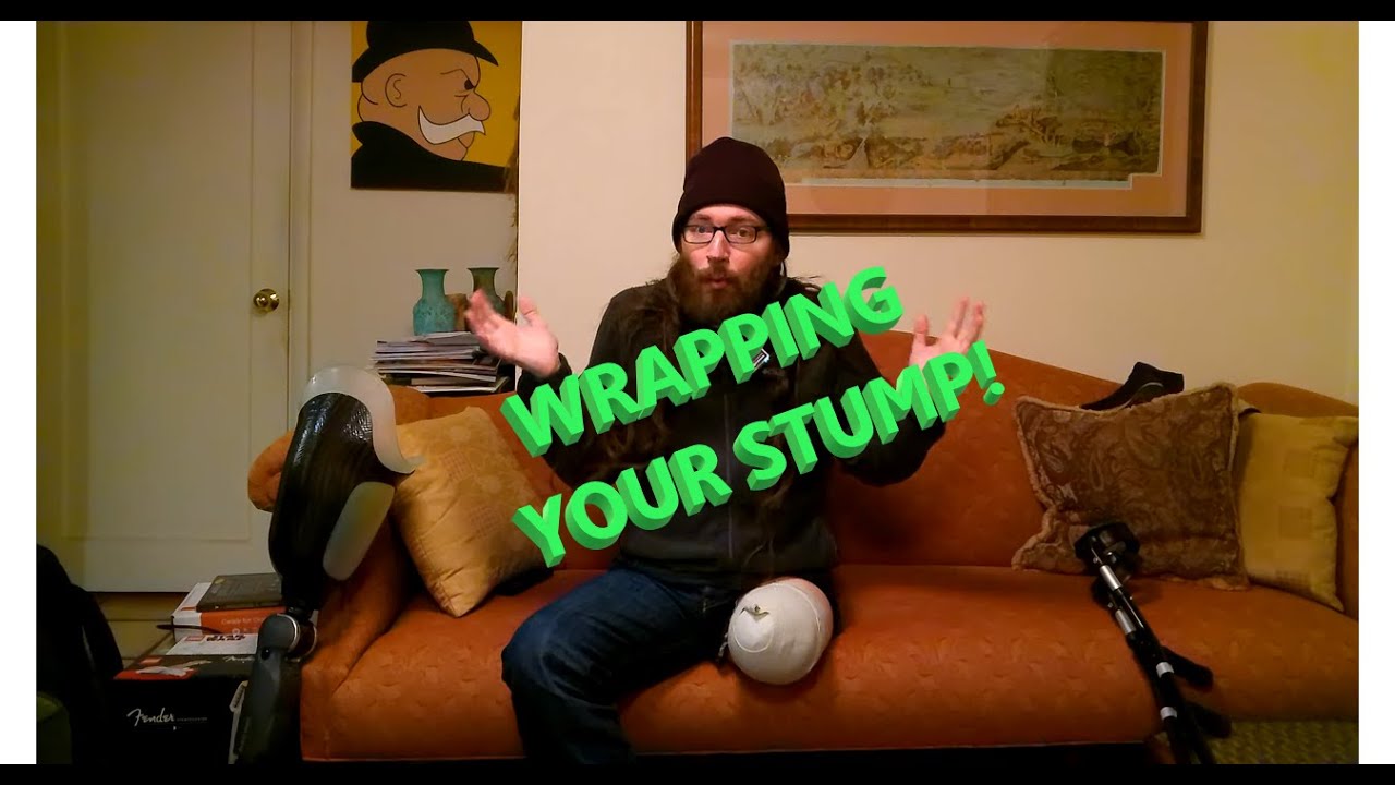 How to Wrap an Above Knee Amputee's Stump! - YouTube