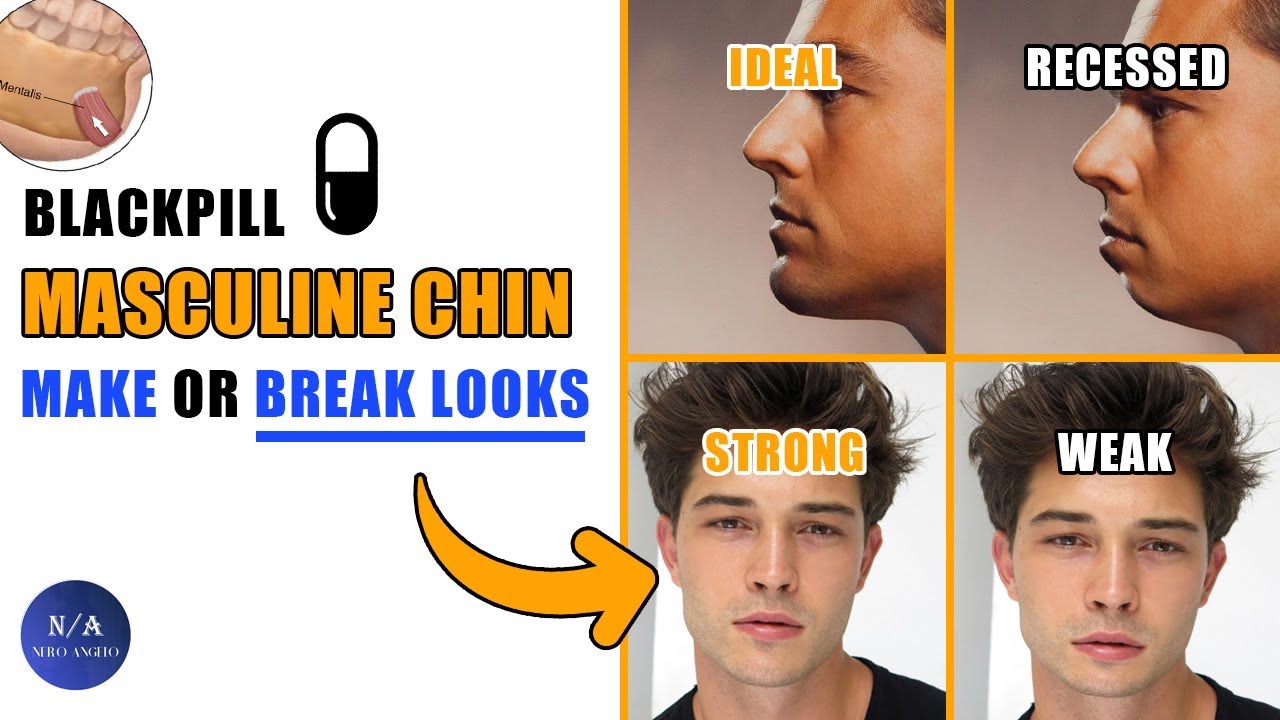 Why Your Chin Can Make Or Break Your Looks ? (blackpill) - YouTube