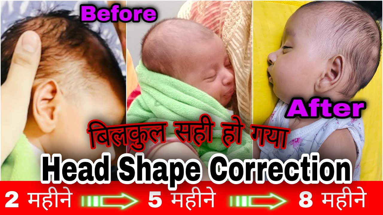 Bache ka sir kaise gol kare -baby head shape correction - Priya vlogs ...
