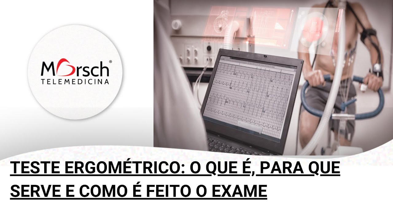 TESTE ERGOMÉTRICO: O QUE É, PARA QUE SERVE E COMO É FEITO O EXAME - YouTube
