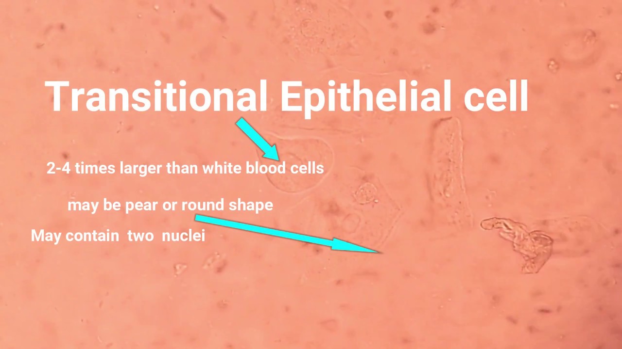 Epithelial cell types and its identification - YouTube