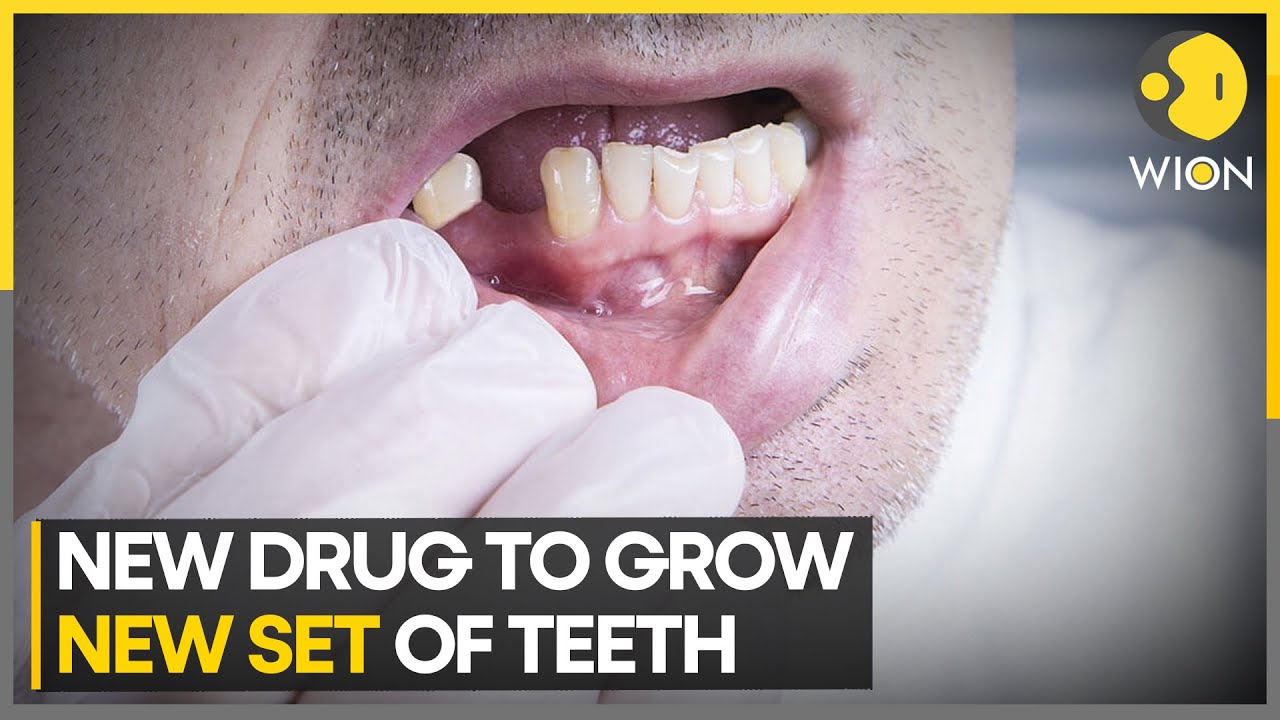 This drug could allow you to grow new teeth | Latest News | WION - YouTube