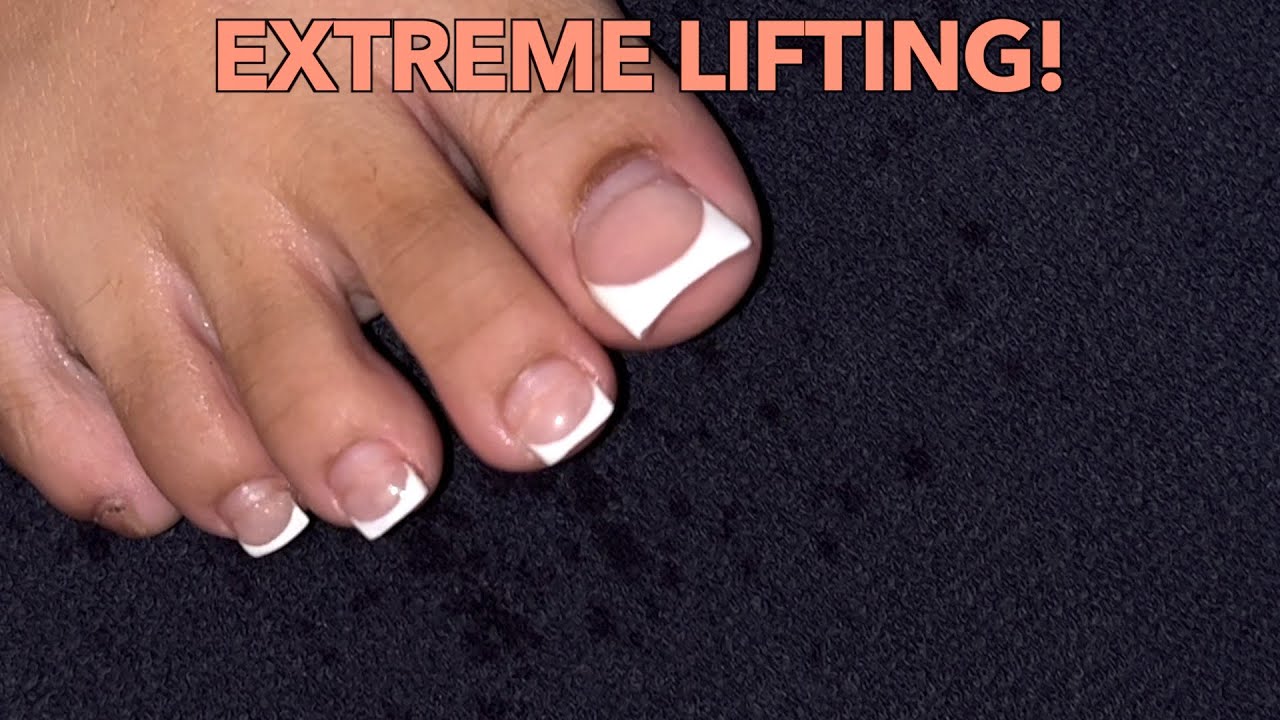 2 MONTH OLD ACRYLIC TOE FILL?! | ACRYLIC FILL WITH LIFTING - YouTube