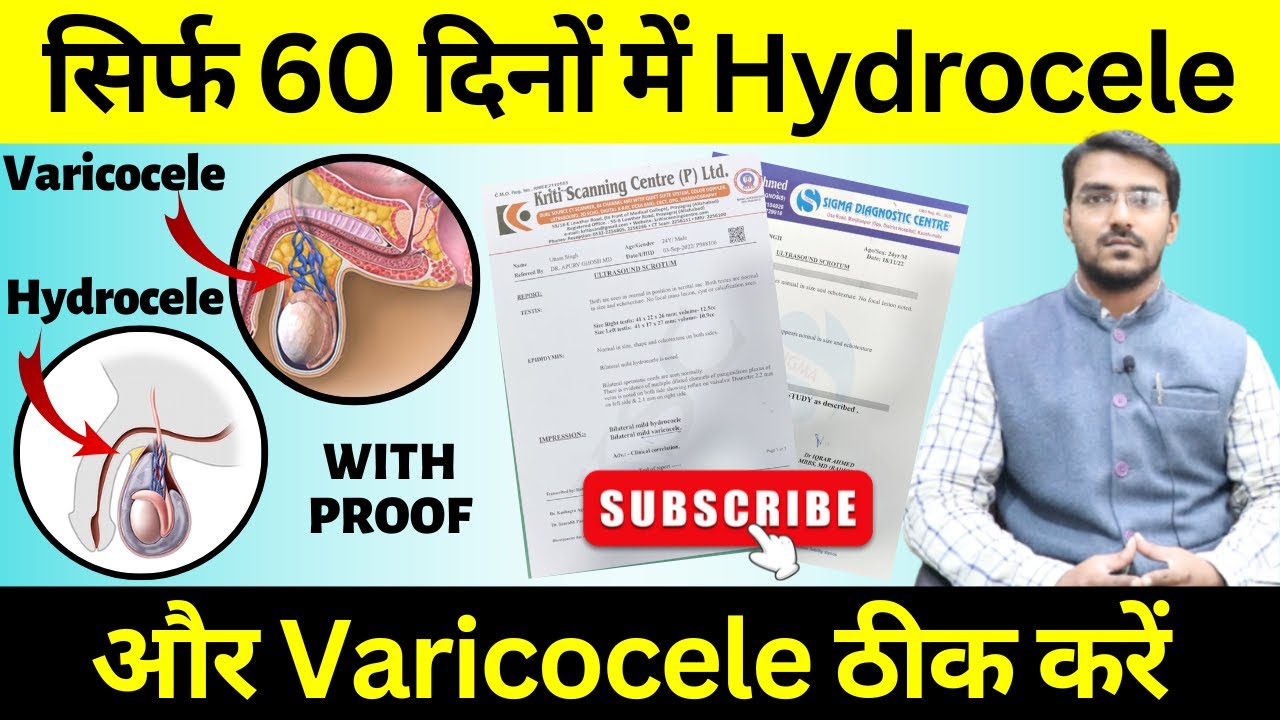 सिर्फ 60 दिनों मे Hydrocele और Varicocele ठीक करें | How to Cure ...
