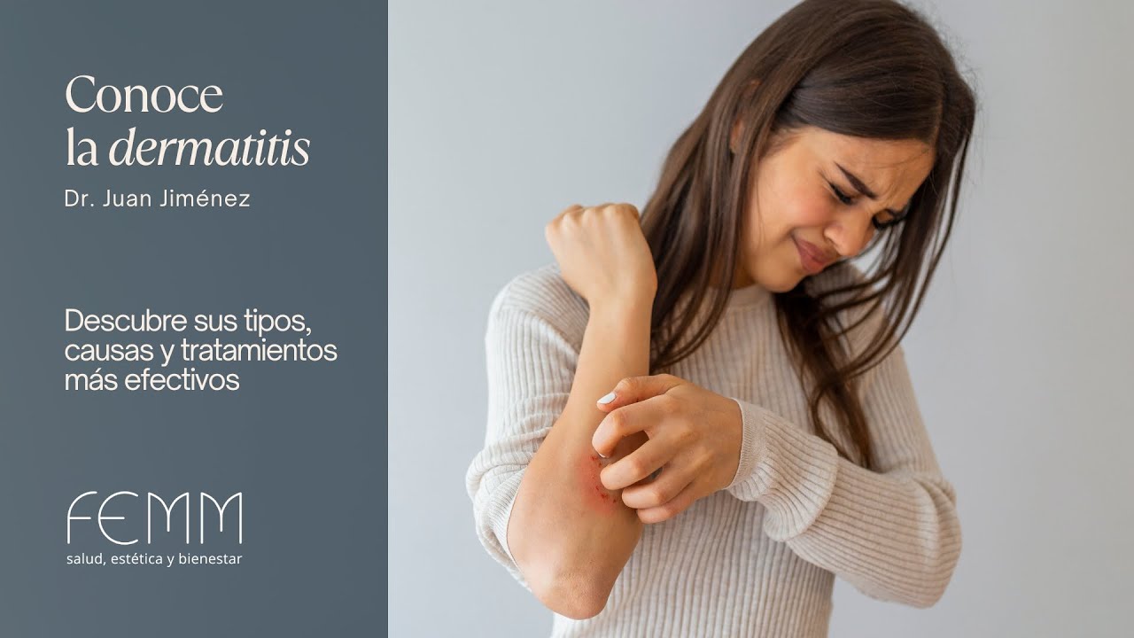 ¿Qué es la dermatitis? Tipos, síntomas y tratamientos - YouTube