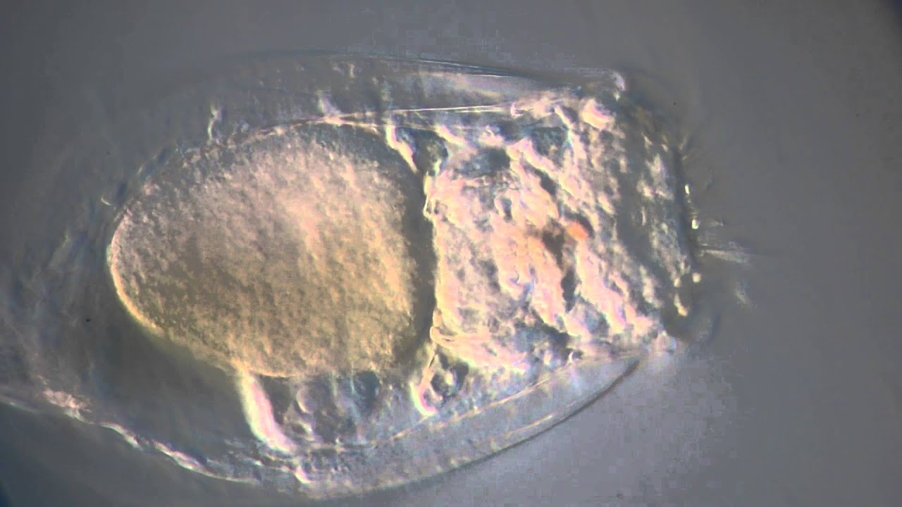 Rotifer Euchlanis Imaged Using a van Egmond Mask II - YouTube