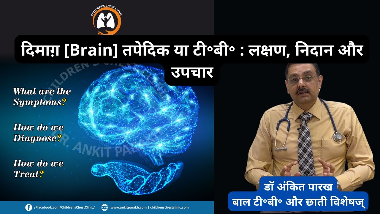 दिमाग़ [Brain] तपेदिक या टी॰बी॰ : लक्षण, निदान और उपचार I डॉ अंकित पारख ...