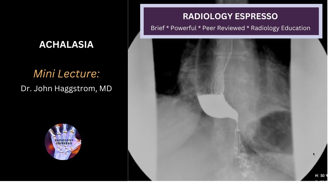 ACHALASIA: Mini Lecture, Dr. John Haggstrom, MD - YouTube