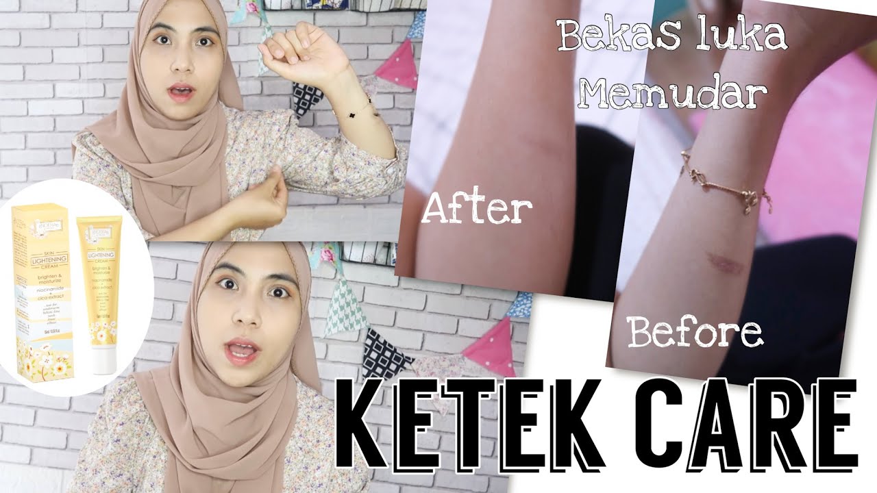 PERAWATAN KETEK JADI GLOWUP | KETEK CARE - YouTube