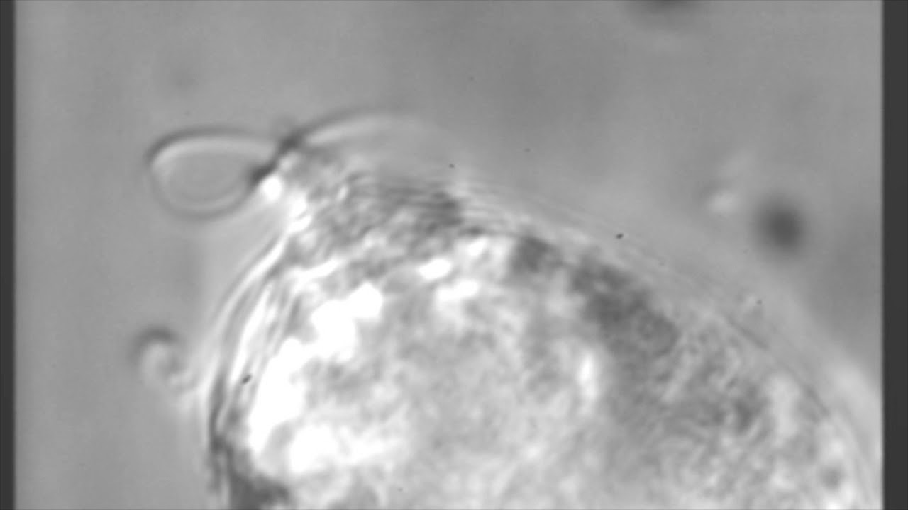 Clip 9 Prorocentrum flagella - YouTube