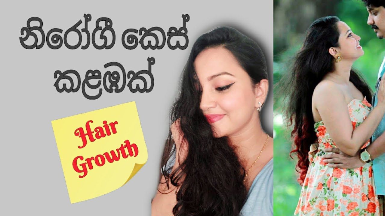 කොණ්ඩෙ යනවද වැවෙන්නෙ නැද්ද එහෙනම් මේ දේවල් අනිවාර්යෙන් කරල බලන්න