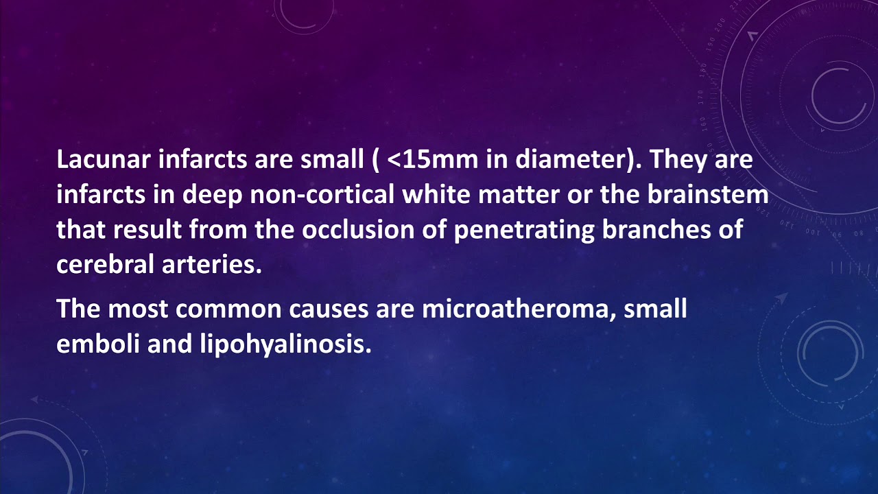 Lacunar Stroke Pathophysiology