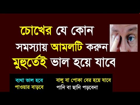 চোখে ব্যথা বা চোখে কিছু পড়লে বা চোখ দিয়ে পানি পড়লে বা চোখ উঠলে বা চোখ লাল হলে করণীয় ও আমল টি করুন