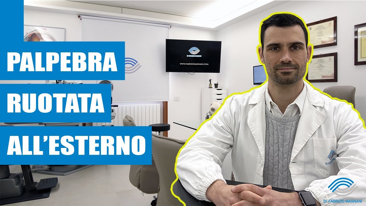 LA PALPEBRA INFERIORE È RUOTATA ALL'ESTERNO - L'ectropion - YouTube