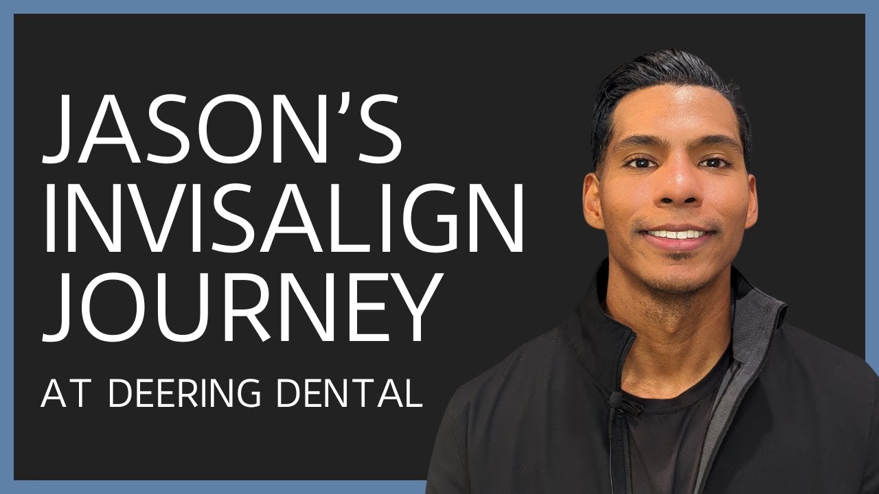 Jason's Invisalign Smile Reveal & Testimonial - YouTube