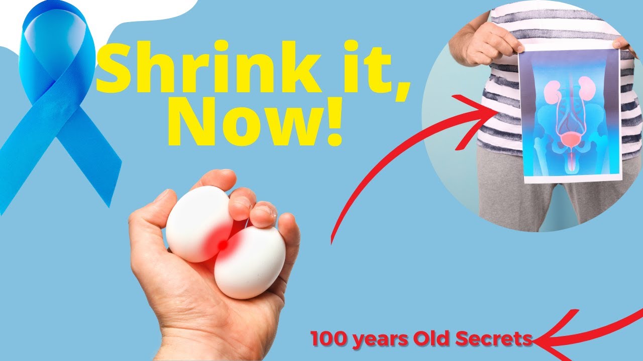 Shrink Enlarged Prostate Naturally: 7 Proven Steps for Optimal Health ...