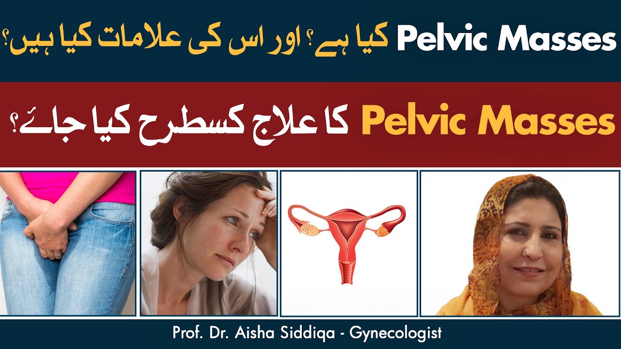 Pelvic Masses In Female Symptoms And Treatment Of Pelvic Masses In Pashto Youtube