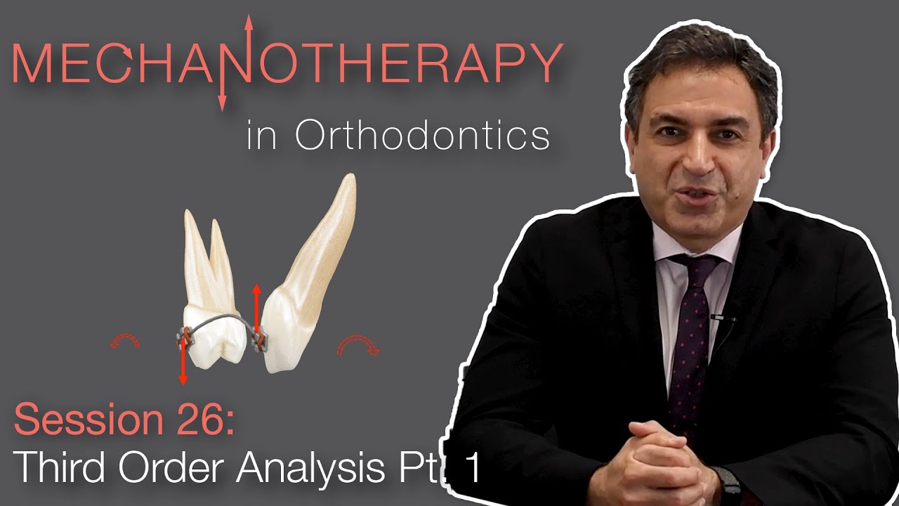 Mechanotherapy in Orthodontics: Third Order Analysis Pt. 1 - YouTube