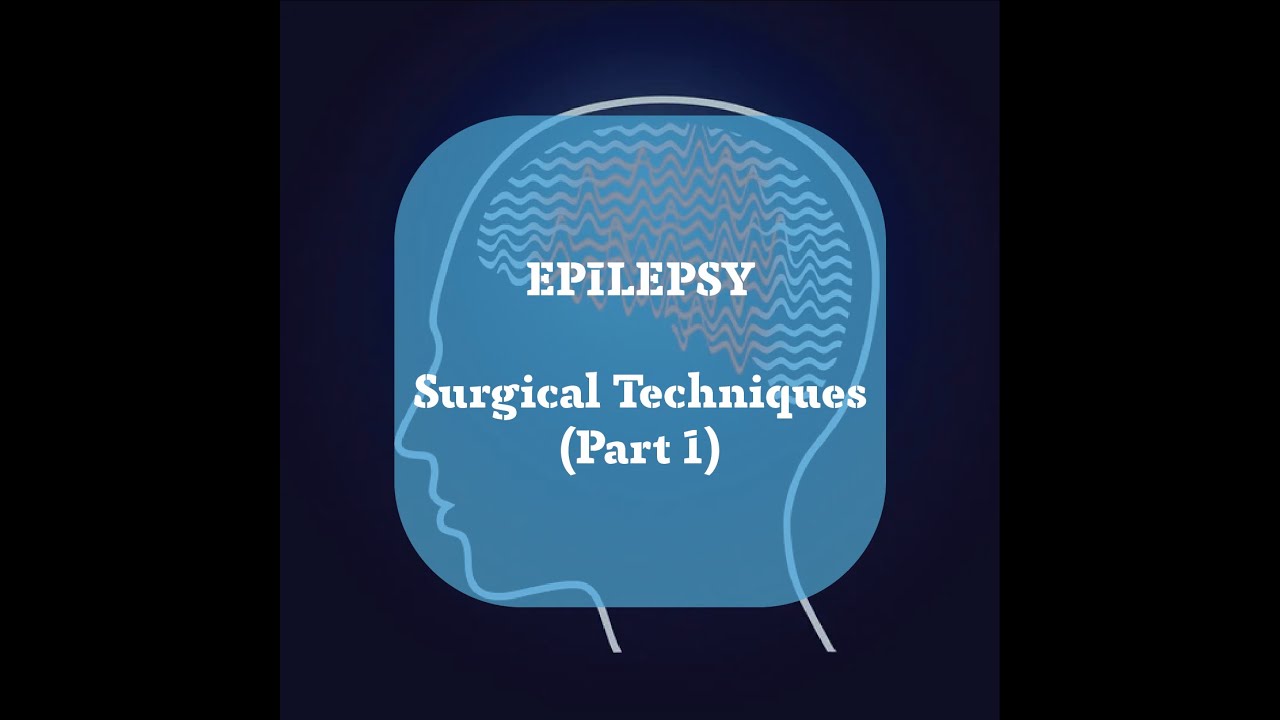 Neurosurgery Basics Lecture : Epilepsy - Surgical Techniques Part 1 ...