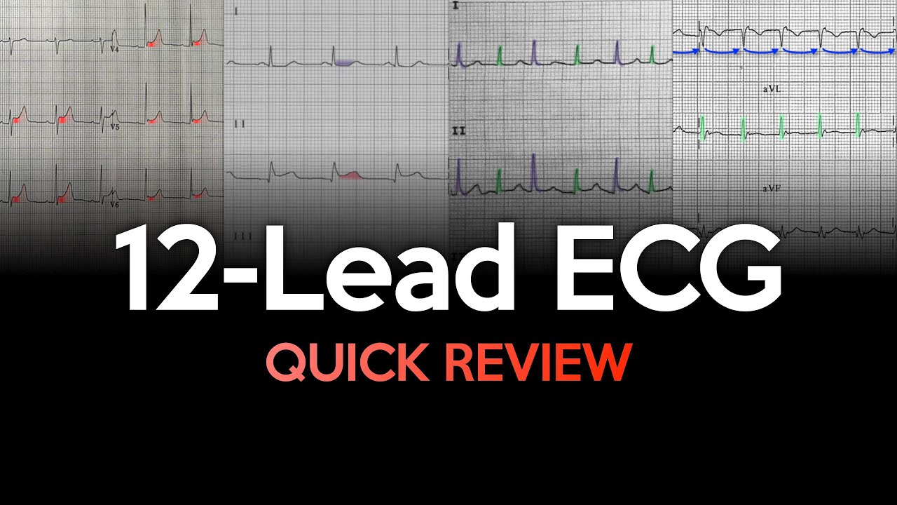 Quick Review of ECGs - YouTube