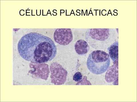 LEUCOCITOS NORMALES Y PATOLÓGICOS.wmv - YouTube